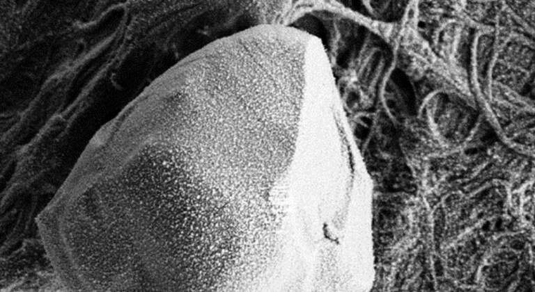 Rasterelektronenmikroskopie (REM): OMPG